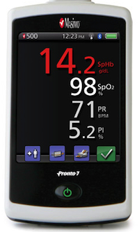 Focus Article: Masimo Corporation (MASI) - InsideArbitrage